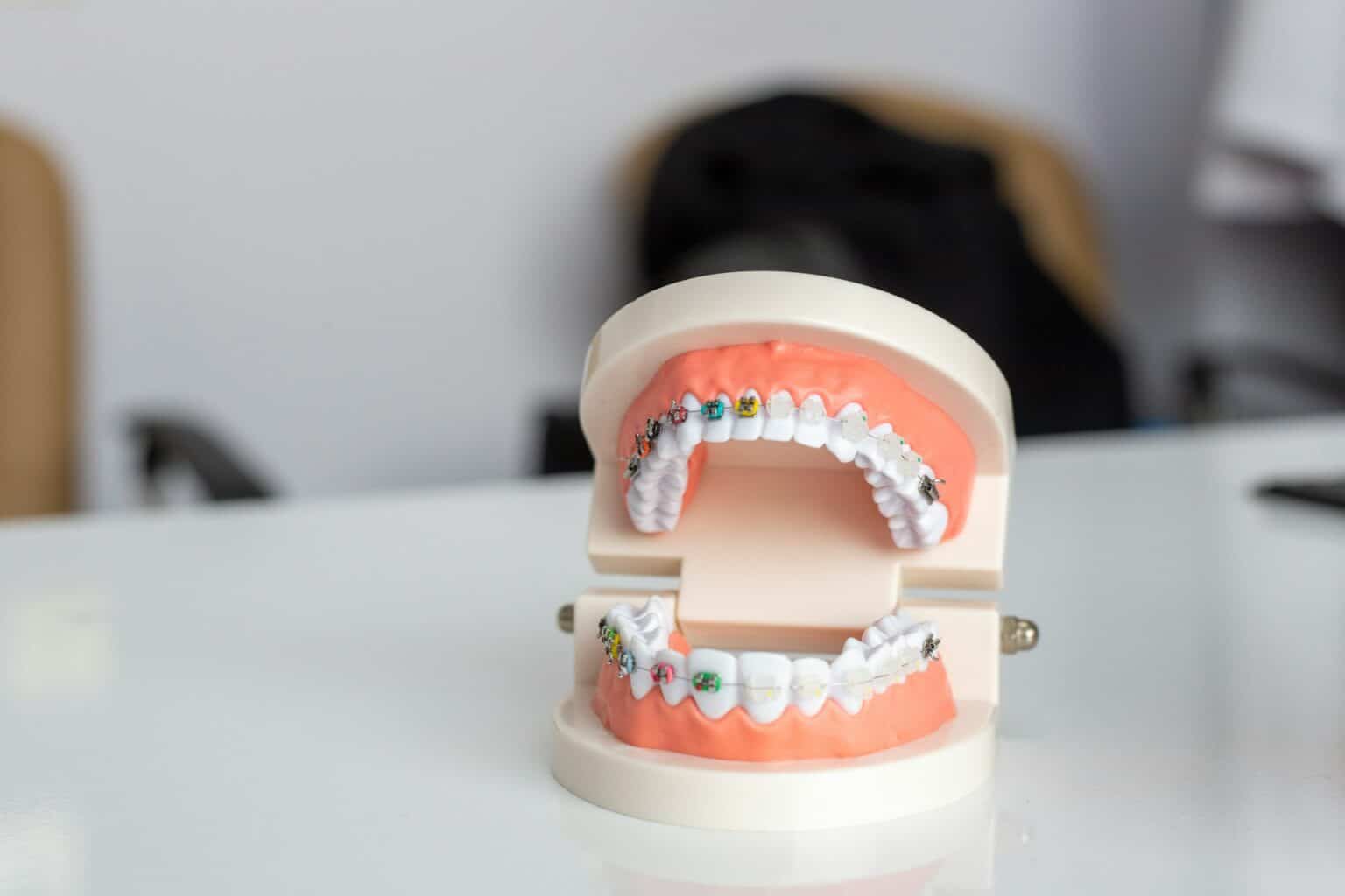 Braces Or Clear Aligners: Which Is The Best Overbite Treatment?